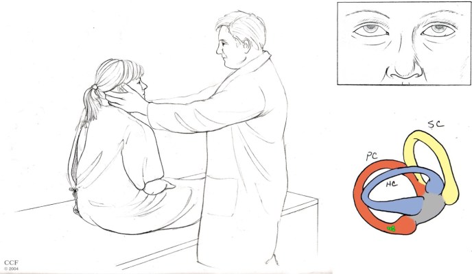 Vestibular Testing | Seattle Dizzy Group